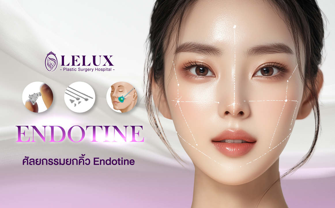 ศัลยกรรมดึงหน้า ยกคิ้ว Endotine - โรงพยาบาลเลอลักษณ์ (Lelux Plastic Surgery Hospital)